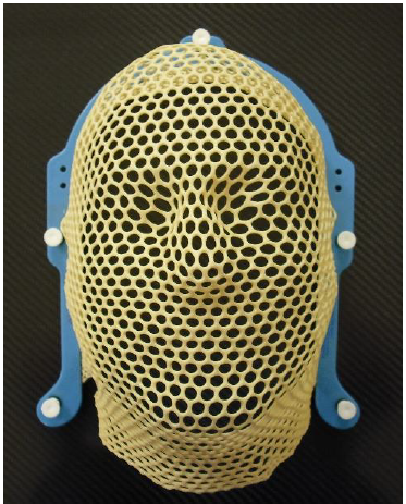 Prophylactic Cranial Irradiation (PCI)